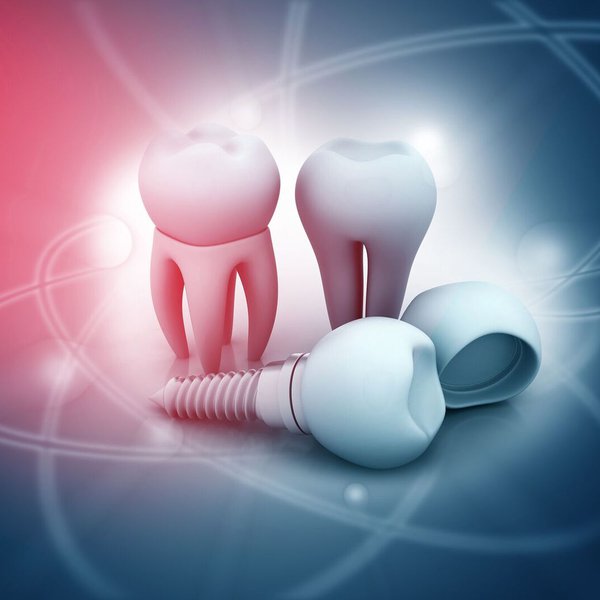 4 Important Questions About Teeth in a Day Your Dentist Can Answer